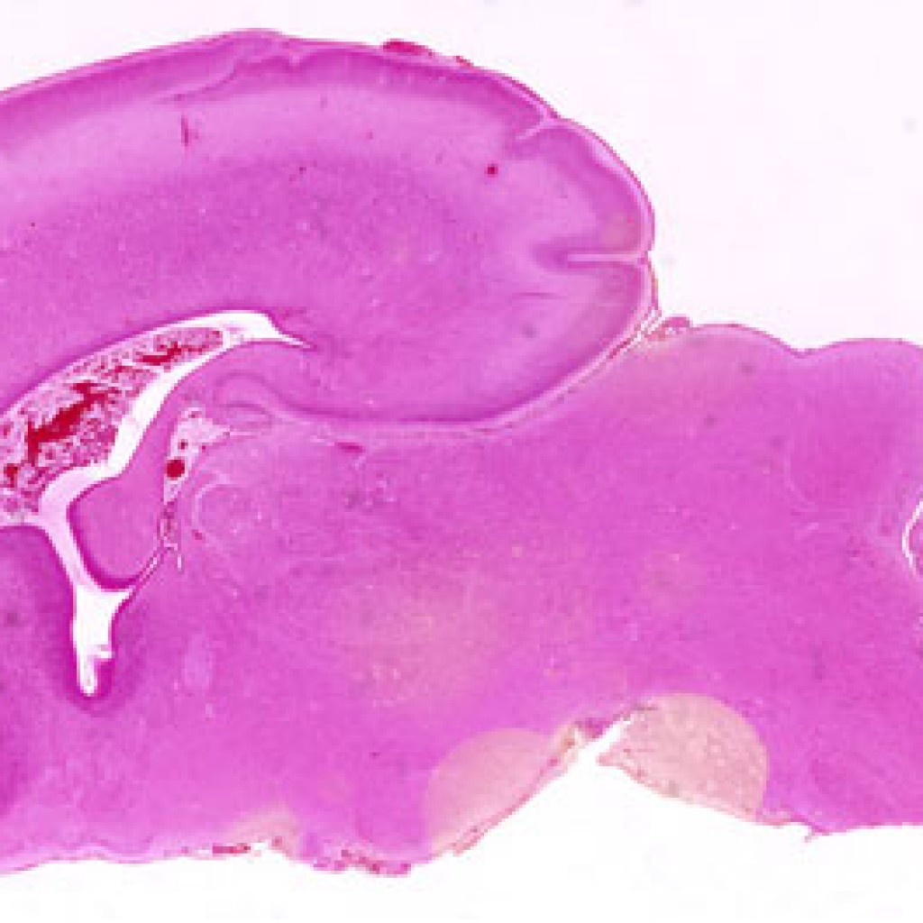 Brain_thumb - Meyer Instruments