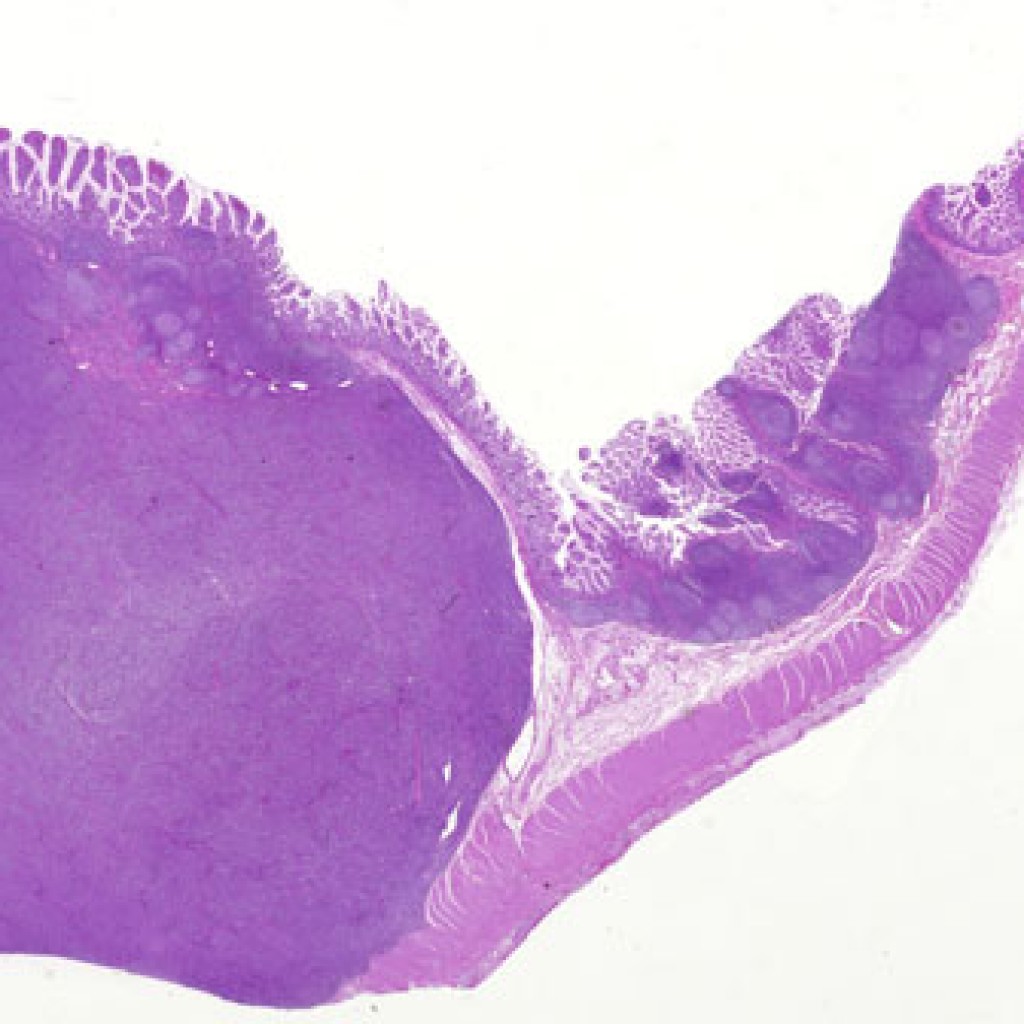 Cecum_thumb - Meyer Instruments