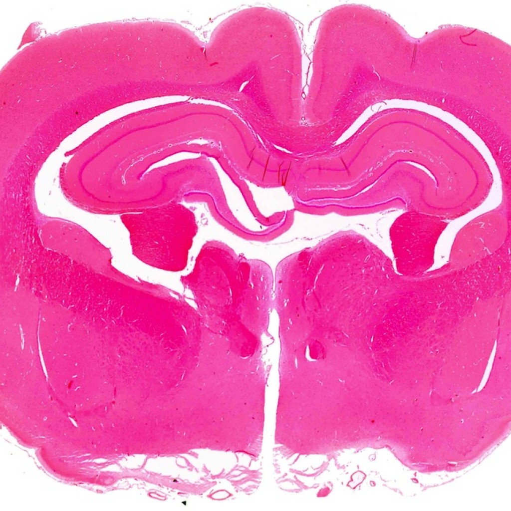 Rat-Brain - Meyer Instruments