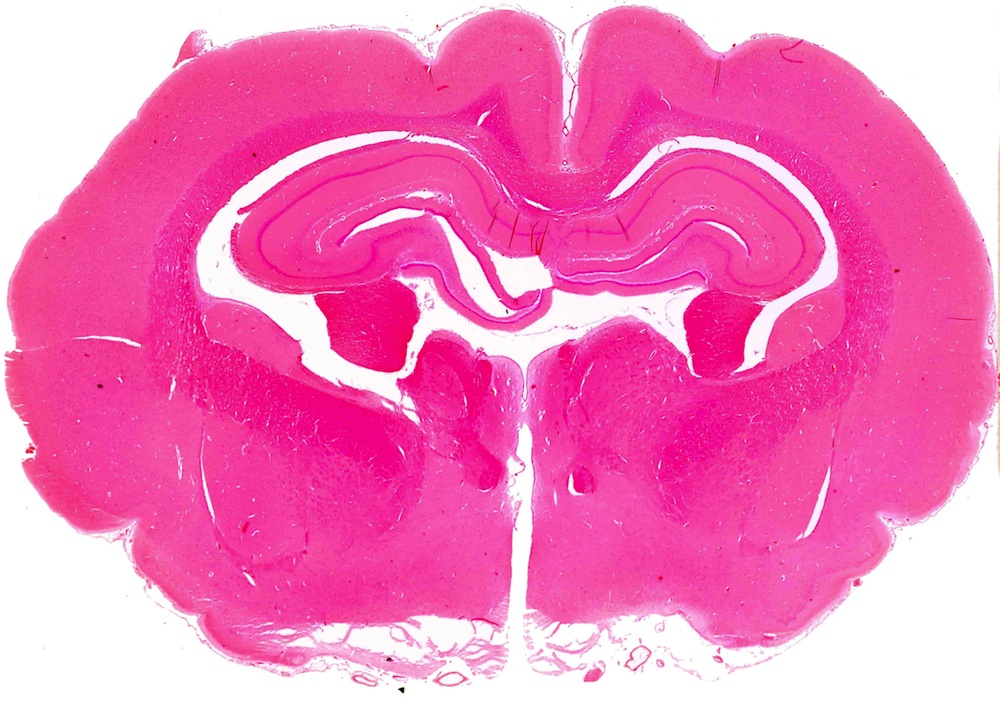Rat-Brain - Meyer Instruments