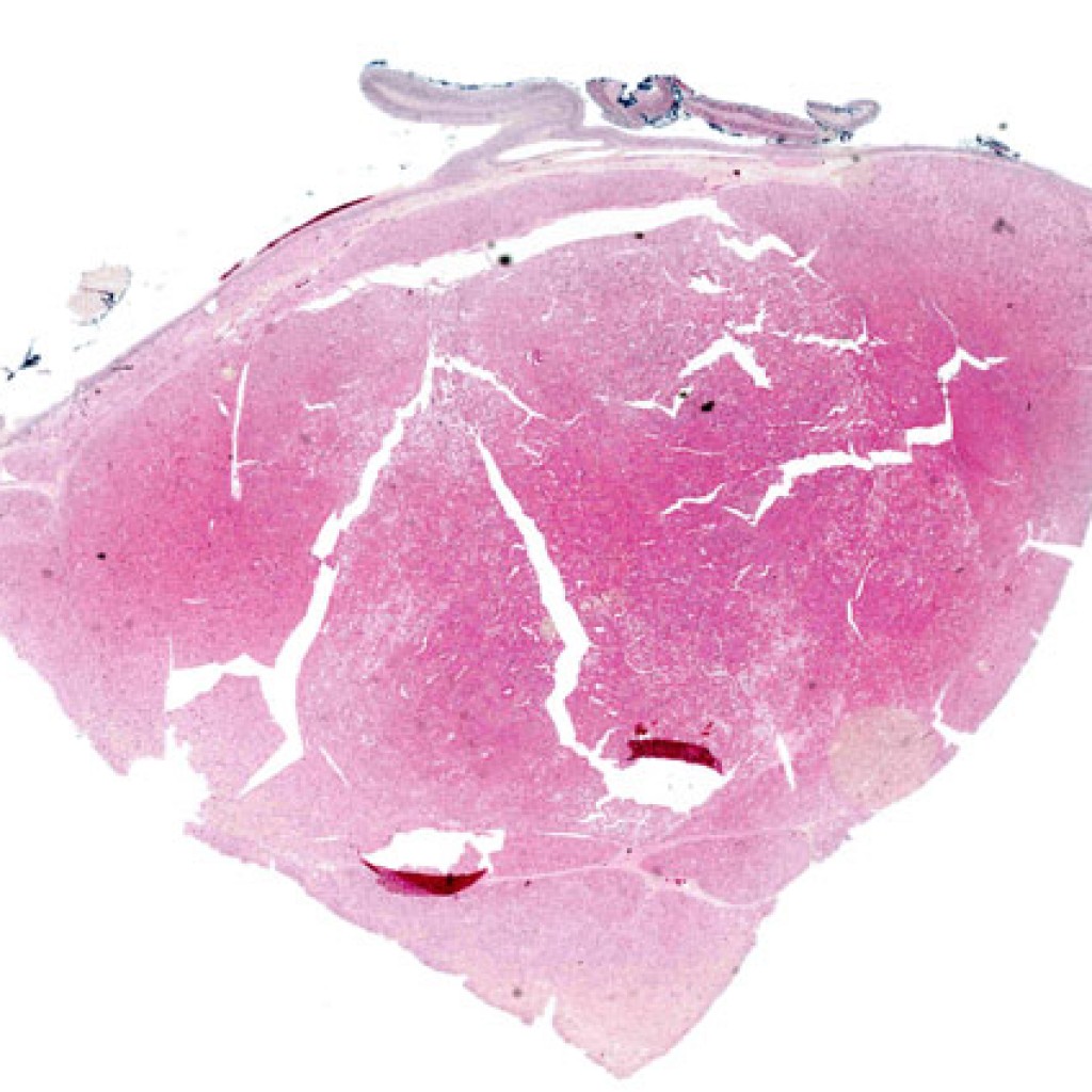 Tissue_thumb - Meyer Instruments