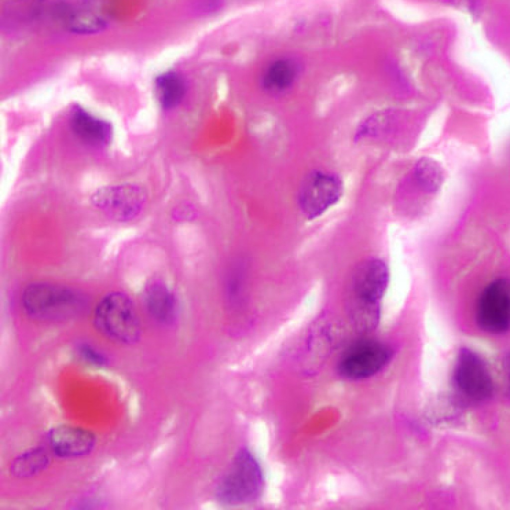 h-e_kidney - Meyer Instruments