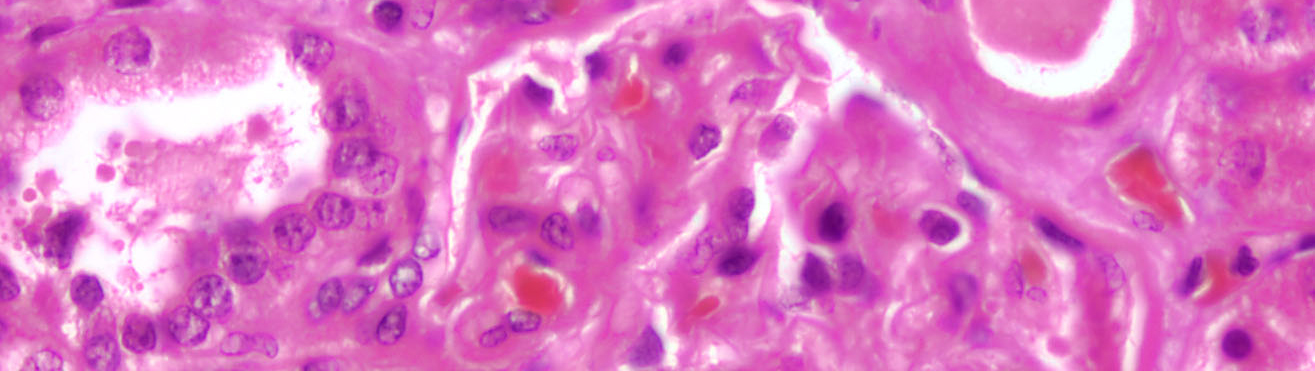 h-e_kidney - Meyer Instruments