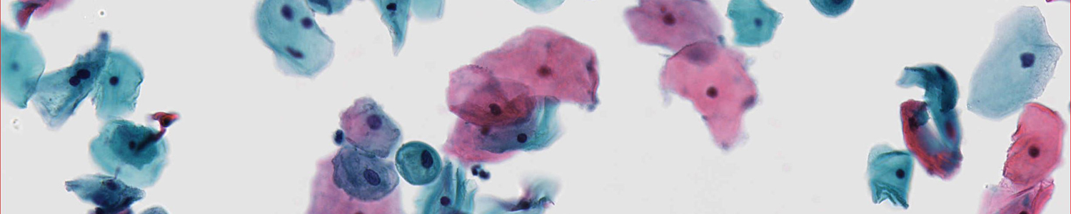 Optronics banner - Meyer Instruments