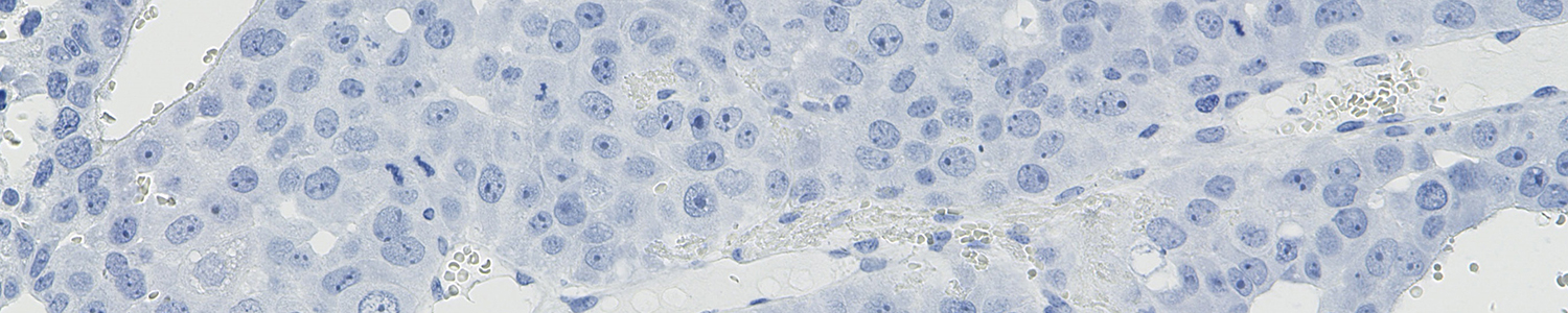 IHC 01 - Meyer Instruments