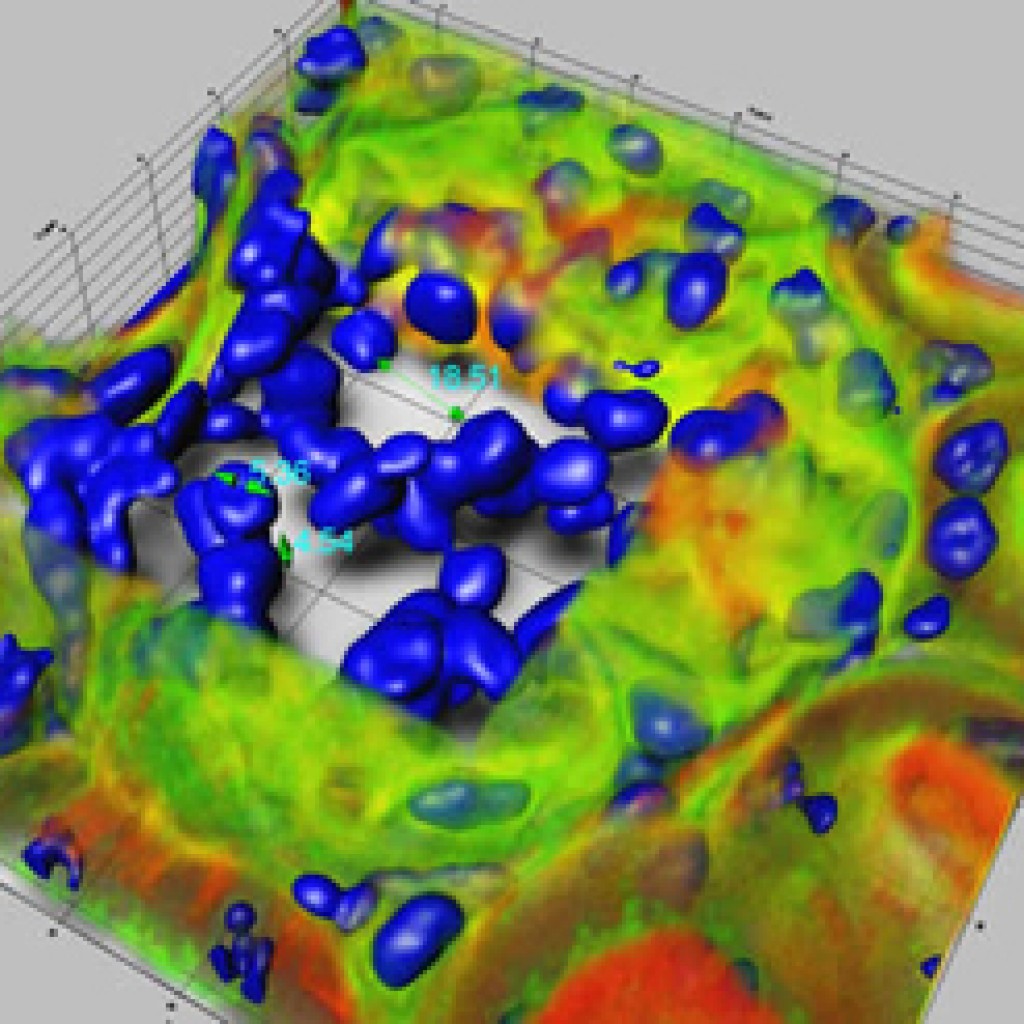 Kidney3DView - Meyer Instruments