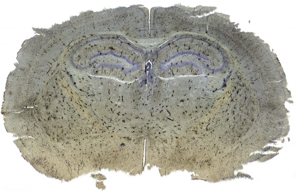 Brain Tissue Sample - Meyer Instruments