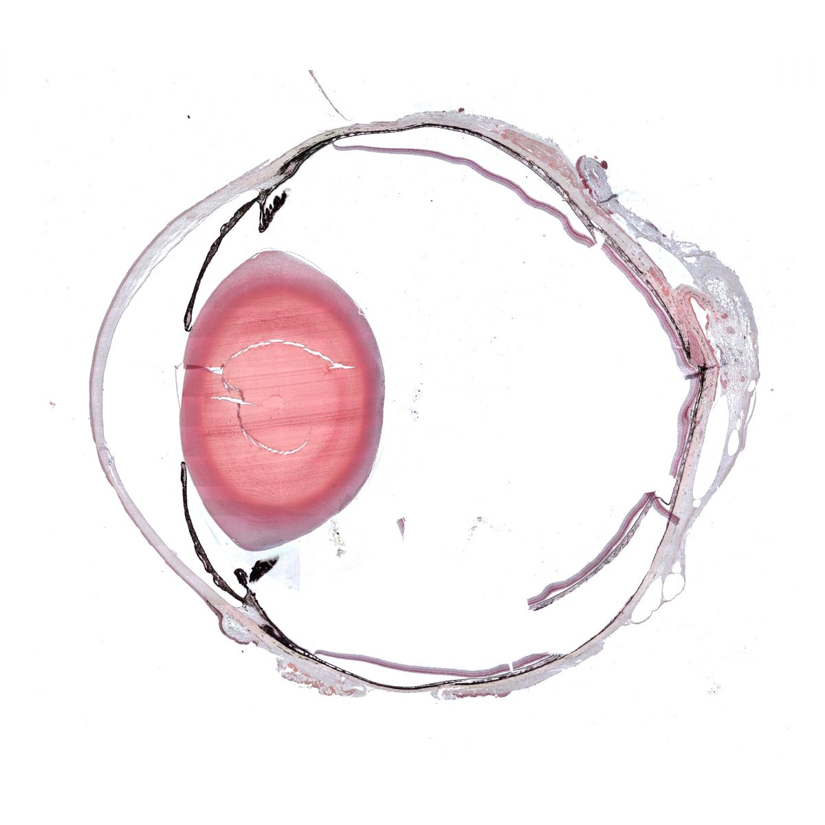 PathScan Enabler 5 is the ORIGINAL low cost Pathology Slide Scanner - Meyer Instruments