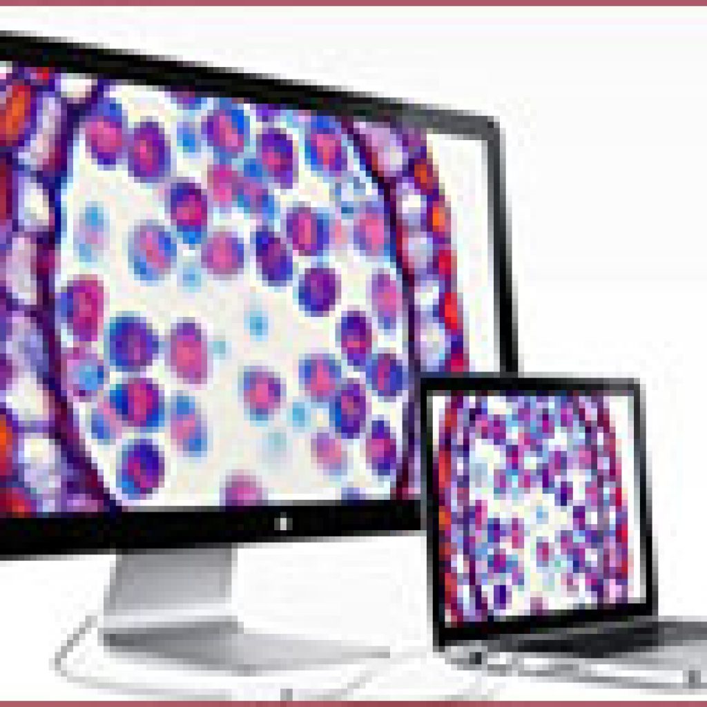 AU-600-HD-Laptop-and-HD-Monitor-sm - Meyer Instruments