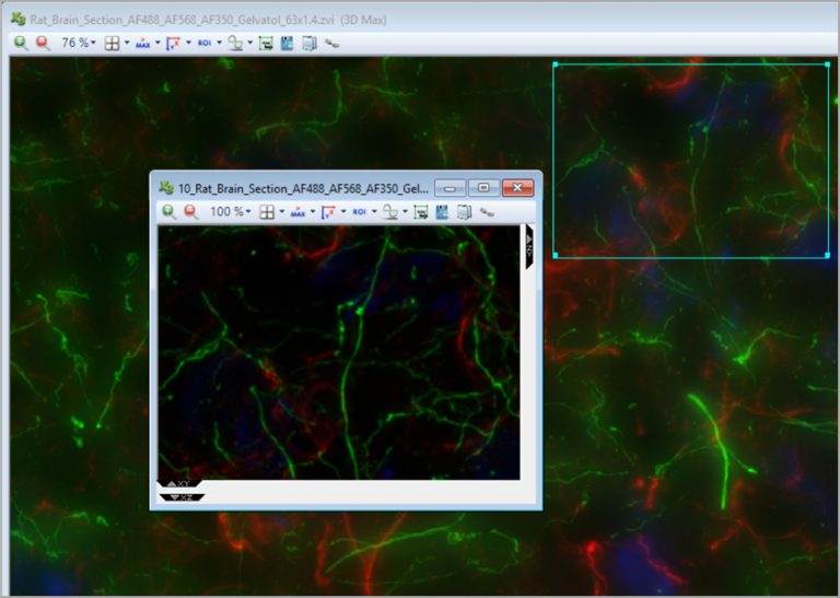 AutoQuant X3 deconvultion software for clear images from Meyer ...