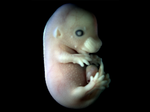 3D mouse embryo . . . HREM - High Resolution Episcopic Microscope ...