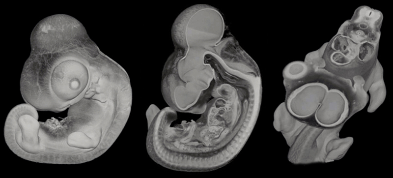 3-views-of-an-embryo 3D image from HREM - Meyer Instruments