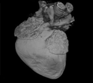 Optical High Resolution Episcopic Microscope for 3D Image generation