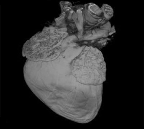 Optical High Resolution Episcopic Microscope for 3D Image generation