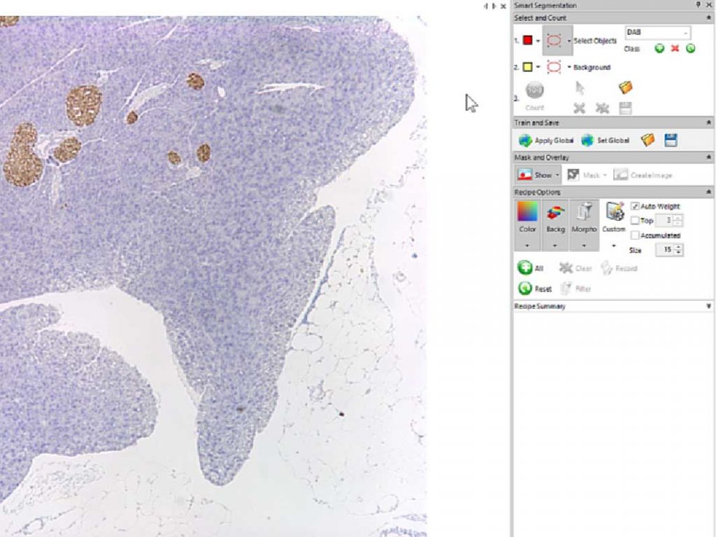 smart-segmentation - Meyer Instruments