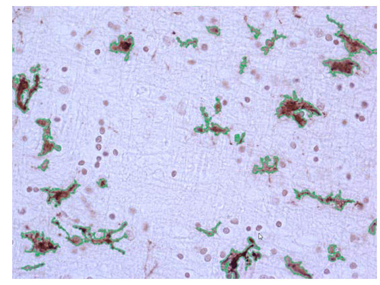brain - Meyer Instruments