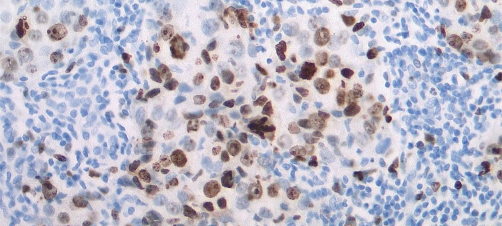 ER-PR image - Meyer Instruments