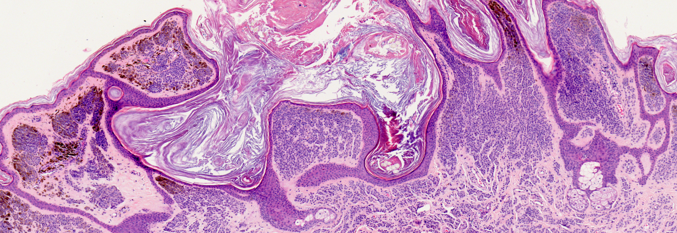 frozen-section - Meyer Instruments