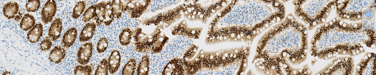 DAB Stained Tissue - Meyer Instruments