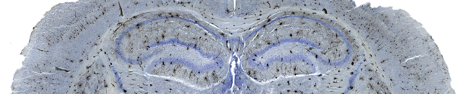 Brain-banner - Meyer Instruments