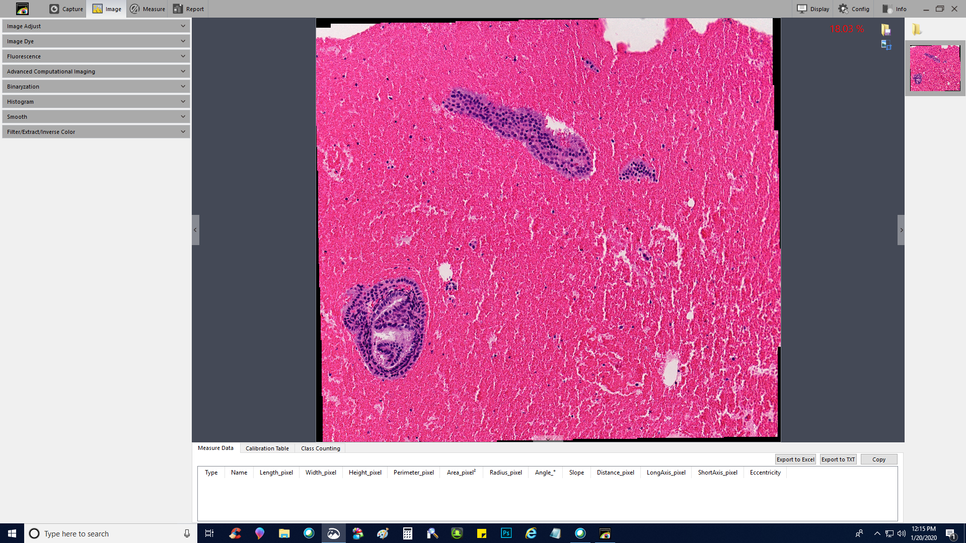 excelis-screen-stitching-40x-screen-shot-final - Meyer Instruments