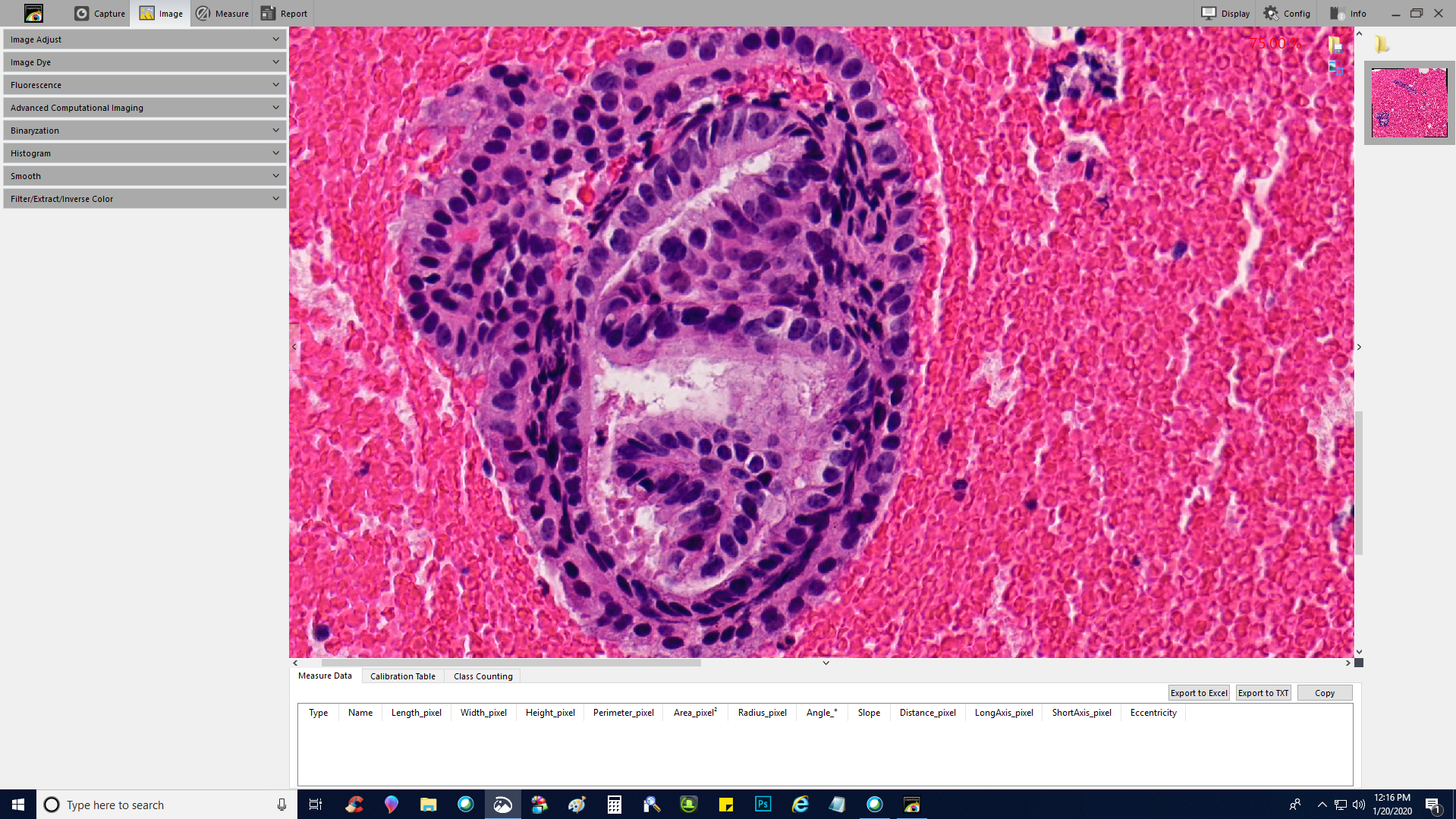 Excelis HD Cameras - Meyer Instruments