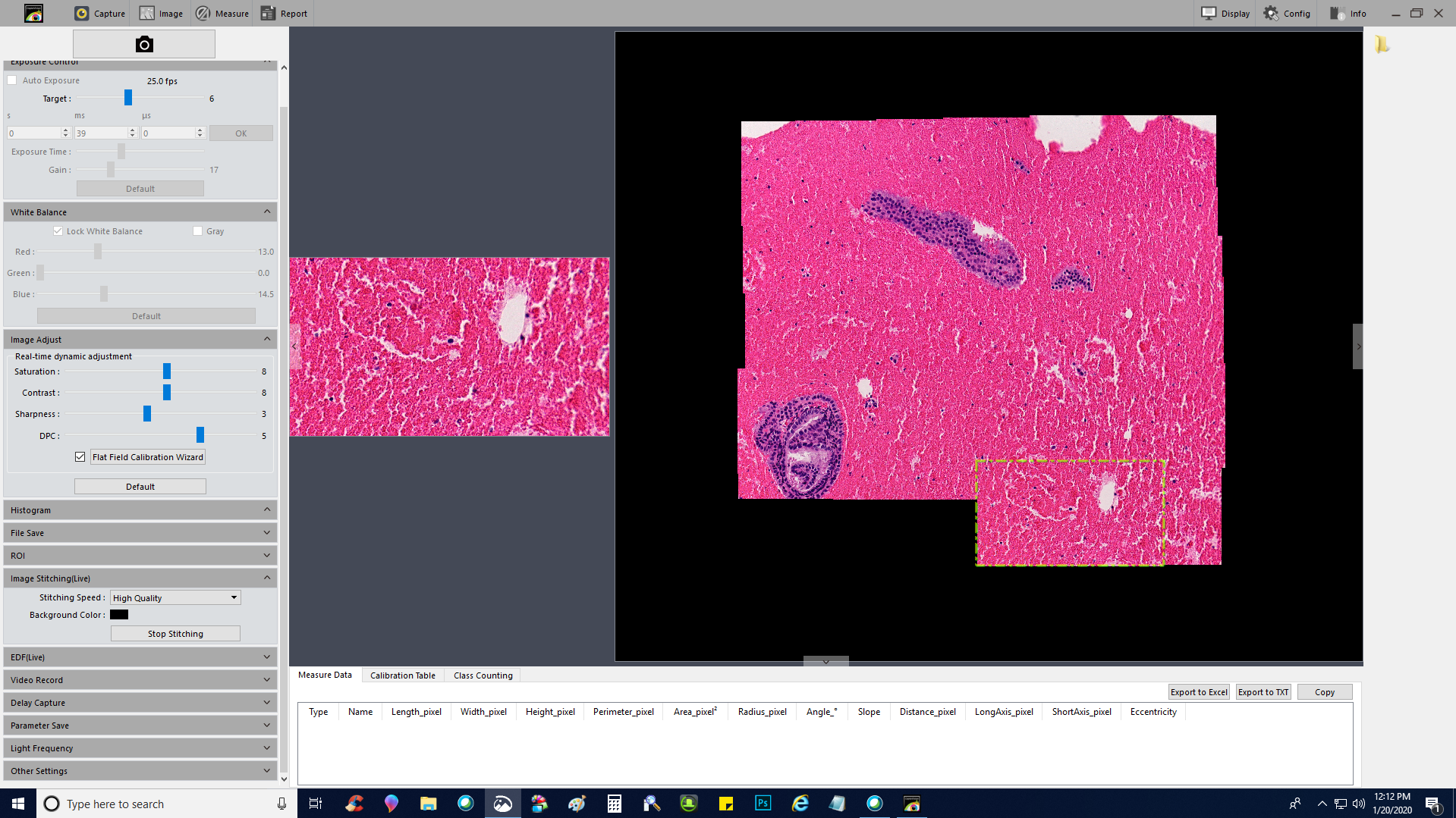 excelis-screen-stitching-40x-screen-shot - Meyer Instruments