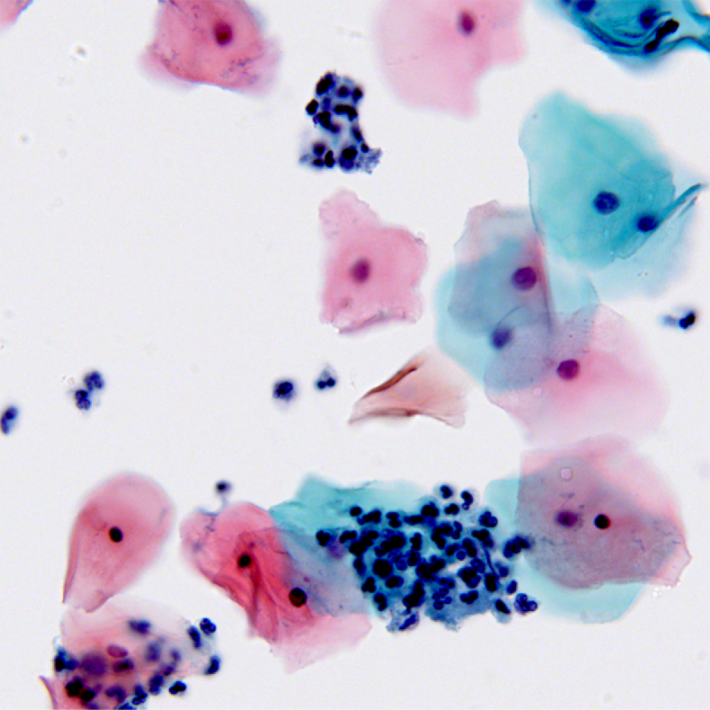 pap-smear - Meyer Instruments