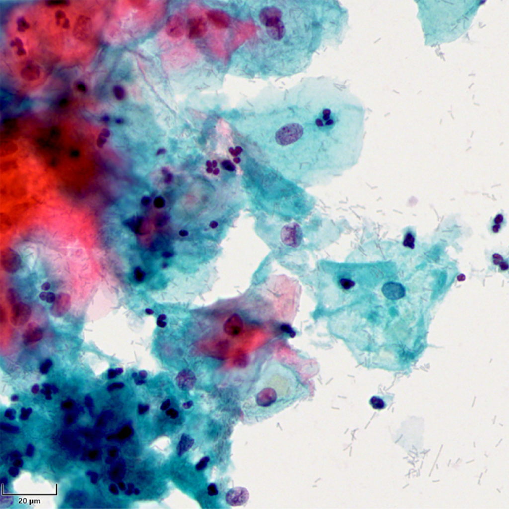 pap-smear - Meyer Instruments