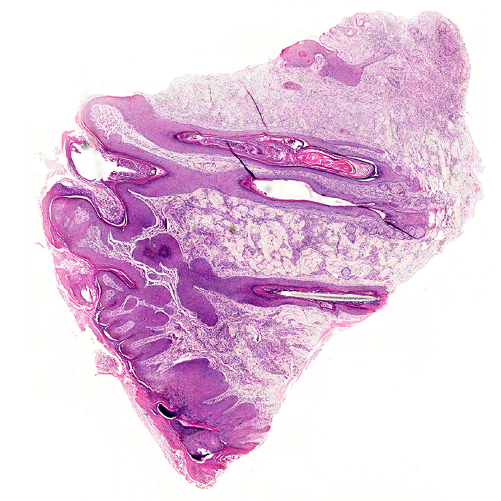 skin-biopsy-Grundium - Meyer Instruments