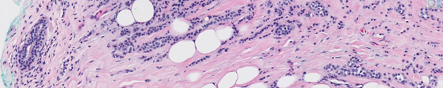 Tissue Sample - Meyer Instruments