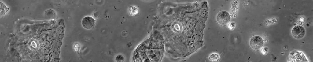 cheek cells-phase contrast - Meyer Instruments