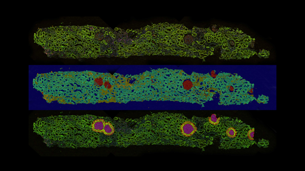kidney - Meyer Instruments