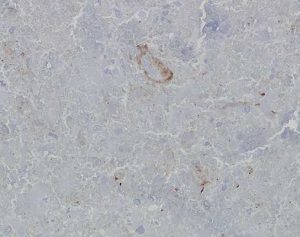 Dage-MTI HD-310U Camera - Meyer Instruments