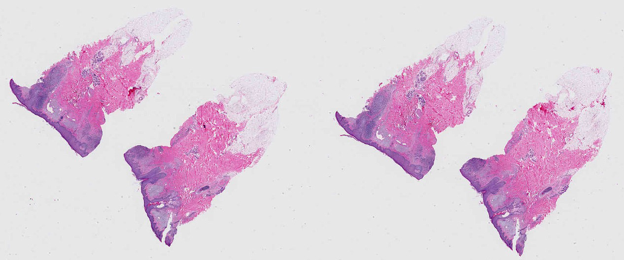 web-path - Meyer Instruments