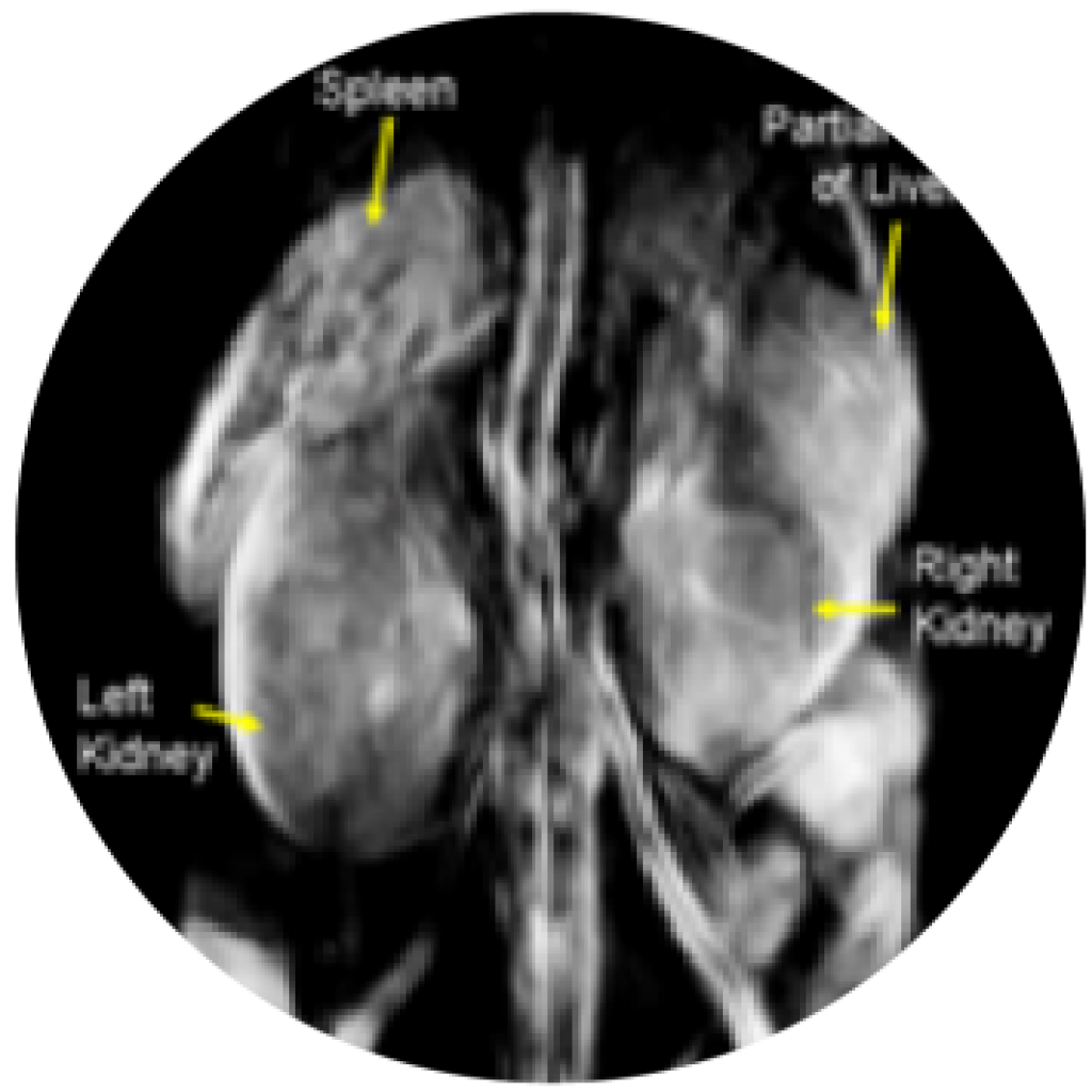 Heliosonix ARIA-3D/4D - Meyer Instruments