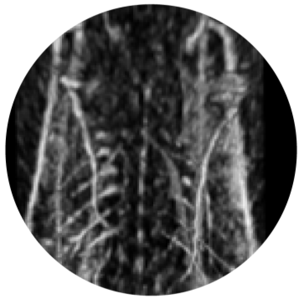 Heliosonix ARIA-3D/4D - Meyer Instruments