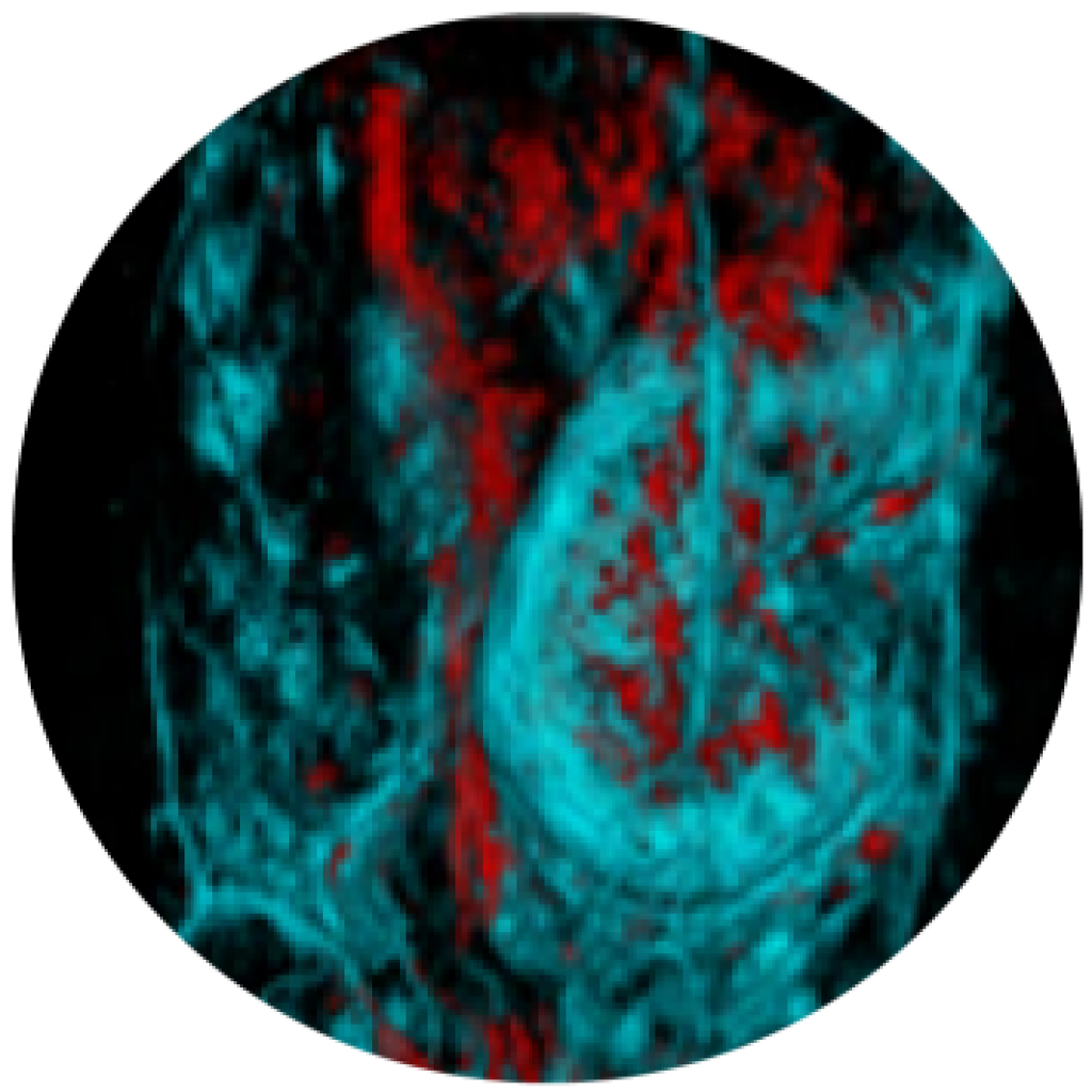 Heliosonix ARIA-3D/4D - Meyer Instruments