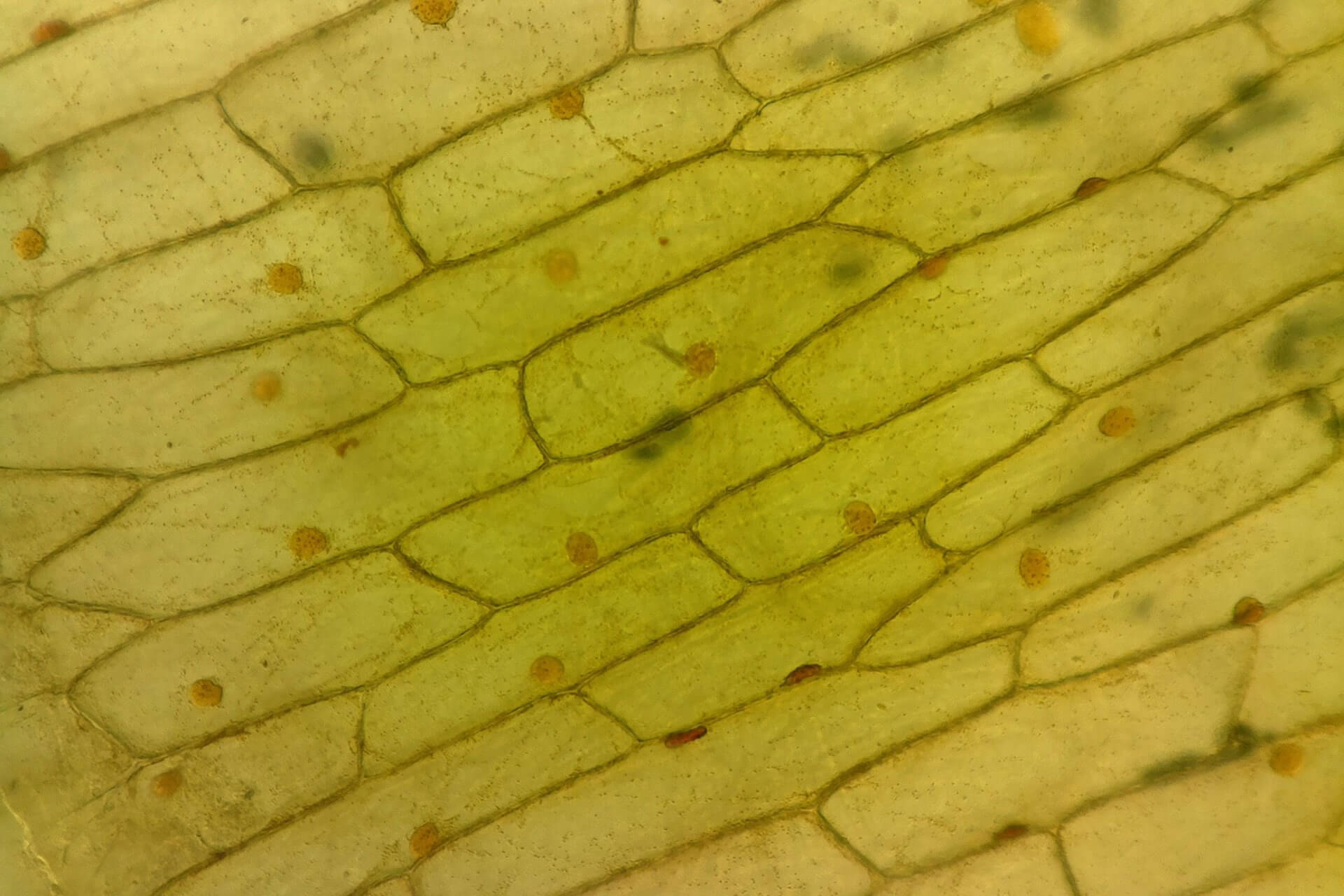 onion-skin-magnified-education-iolight - Meyer Instruments