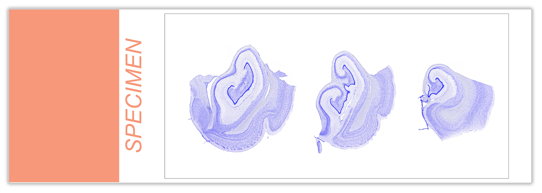 3-brains_ds_sm - Meyer Instruments