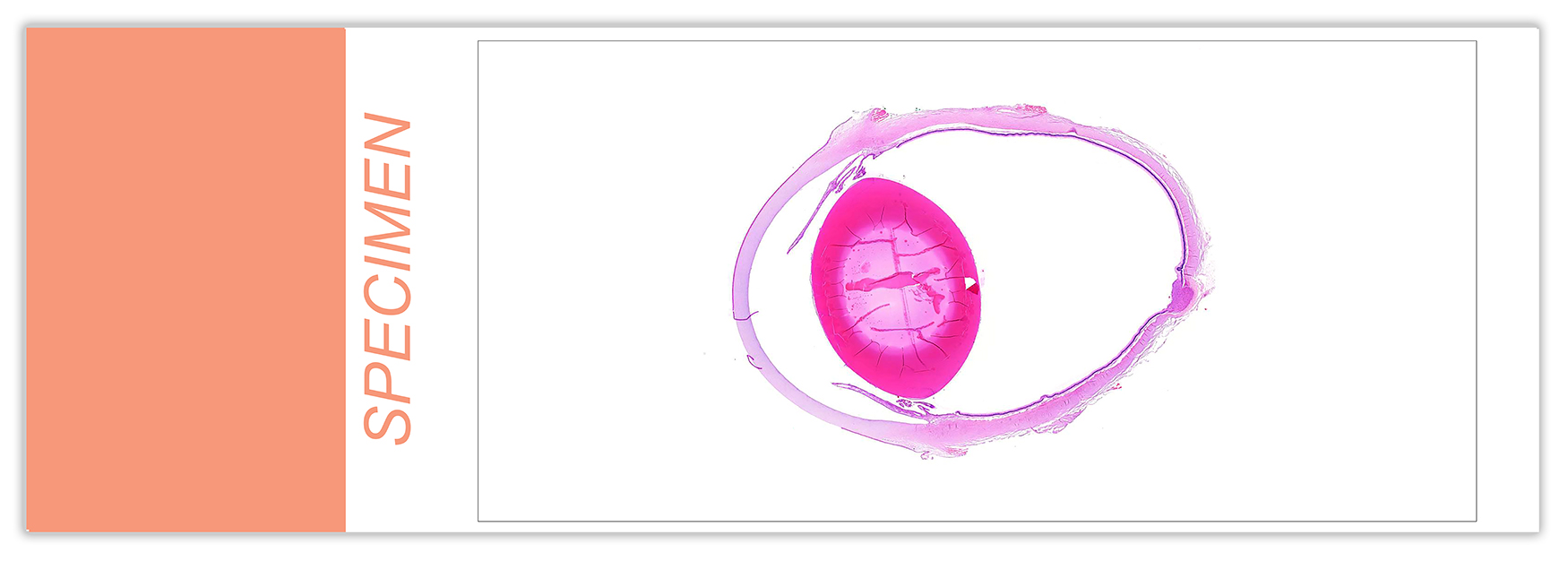 Mouse eye - Meyer Instruments