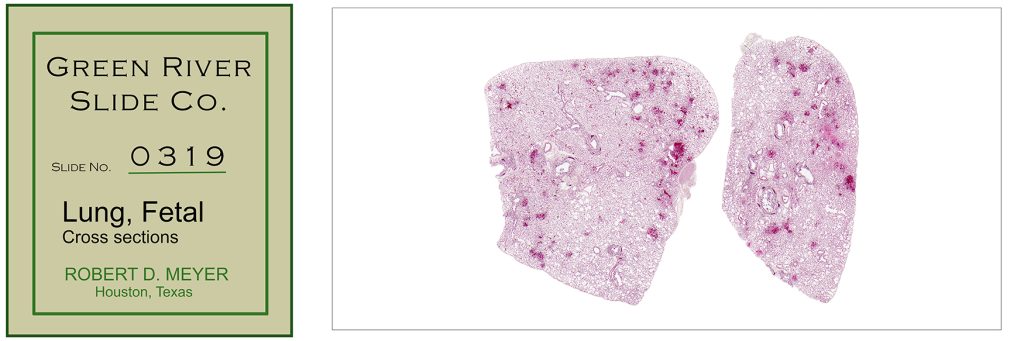 319_fetal-lung-ds_sm - Meyer Instruments