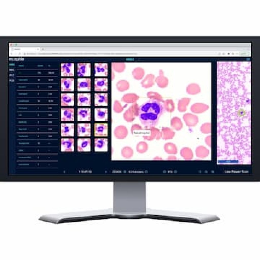 HemoLens 1, Oil Immersion Slide Scanner - Meyer Instruments