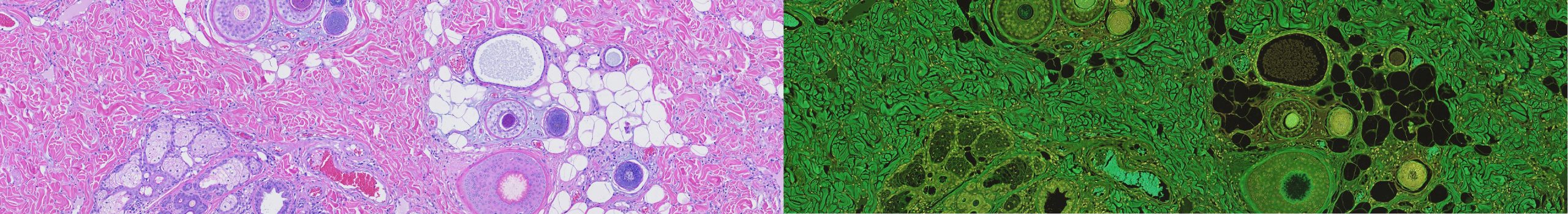 moticflexscan_60_banner_1 - Meyer Instruments