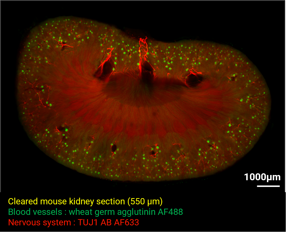 2.1 - Meyer Instruments