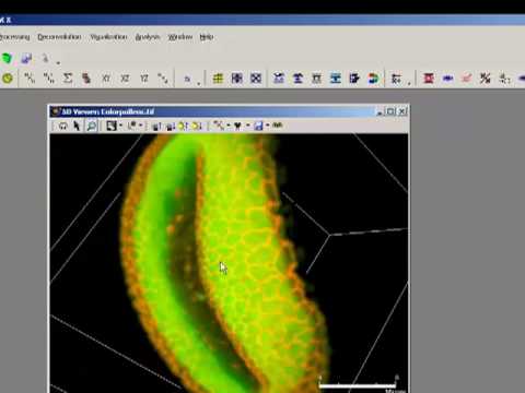 AutoQuant deconvultion software for clear images from Meyer Instruments ...